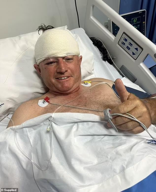 Former Zimbabwe All-Rounder Guy Whittall Survives Leopard Attack ...