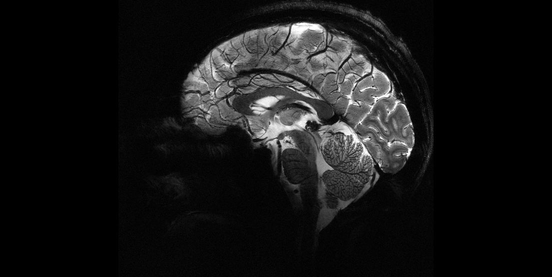 World's Most Powerful MRI Scans 1st Images Of Human Brain | TimelineDaily