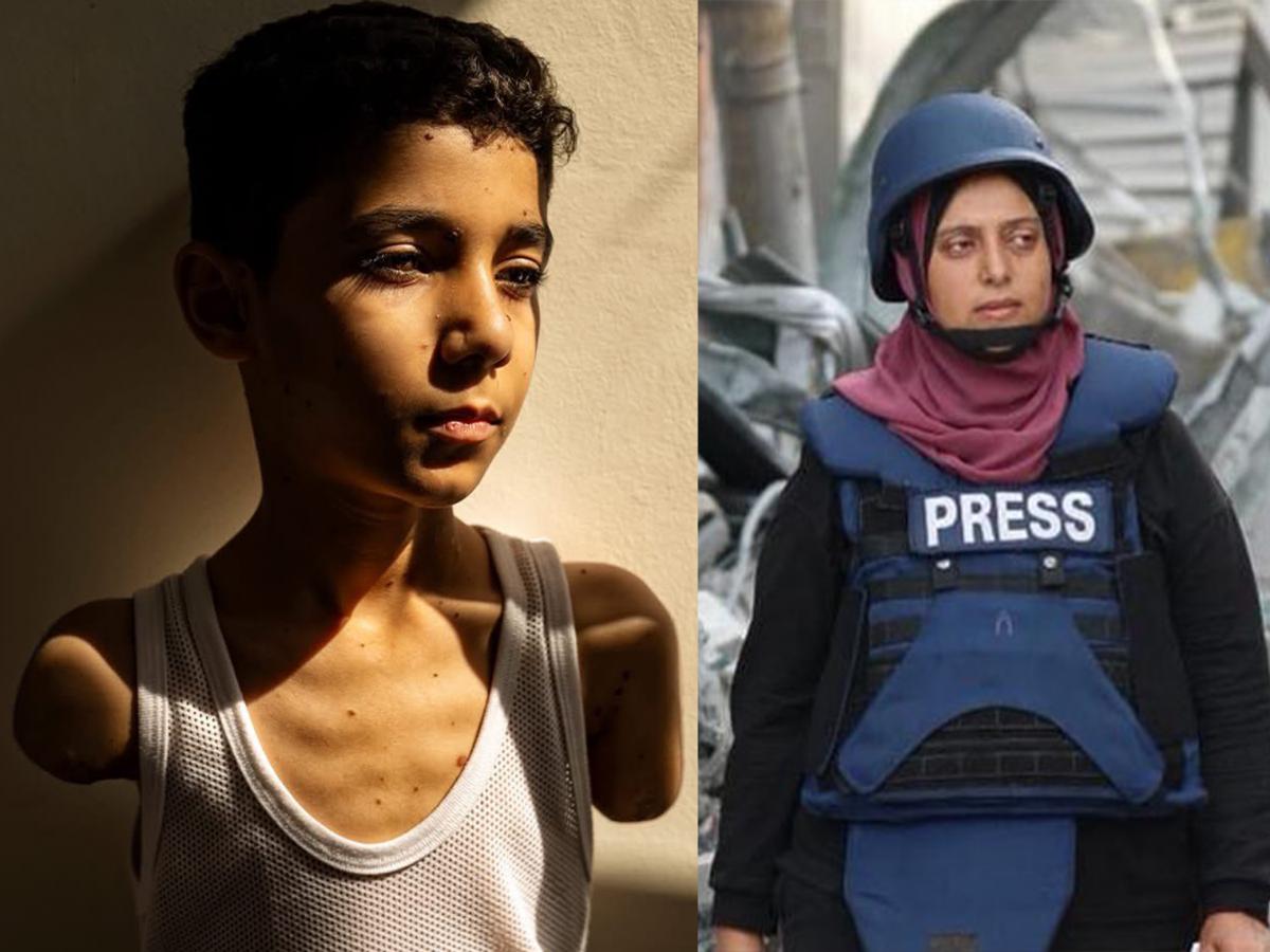 Portrait Of Palestinian Boy Who Lost Arms Wins World Press Photo Of The ...
